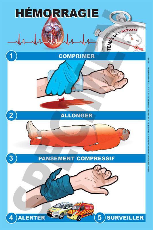 Medical infographic : Editions Icone Graphic – Premiers Secours ...