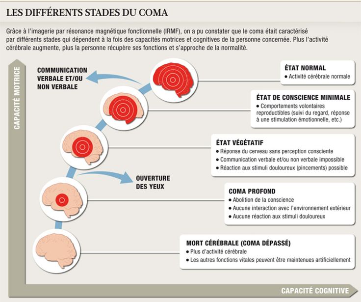 Educational infographic : Les différents stades du coma ...